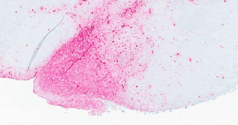 Three Reliable Ways to Test Deer for CWD